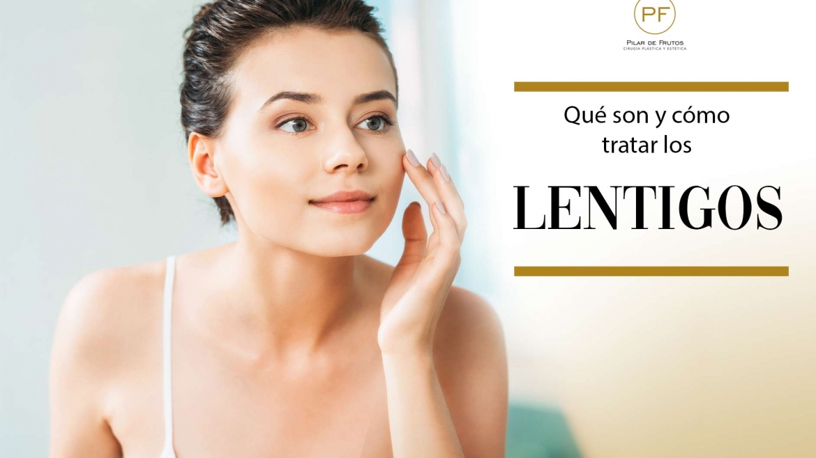 Qué son y como tratar los lentigos - Pilar de Frutos